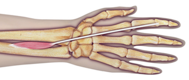 Extensor Indicis Proprius Eip Anatomy Anatomic Structures At Risk